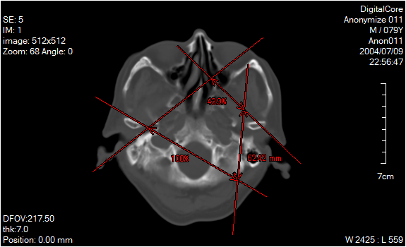 Onis Free Dicom Viewer Azvast
