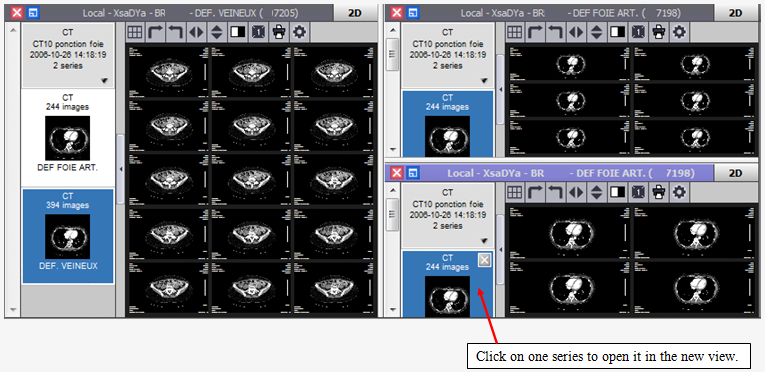 Onis Viewer - Dicom viewer and PACS