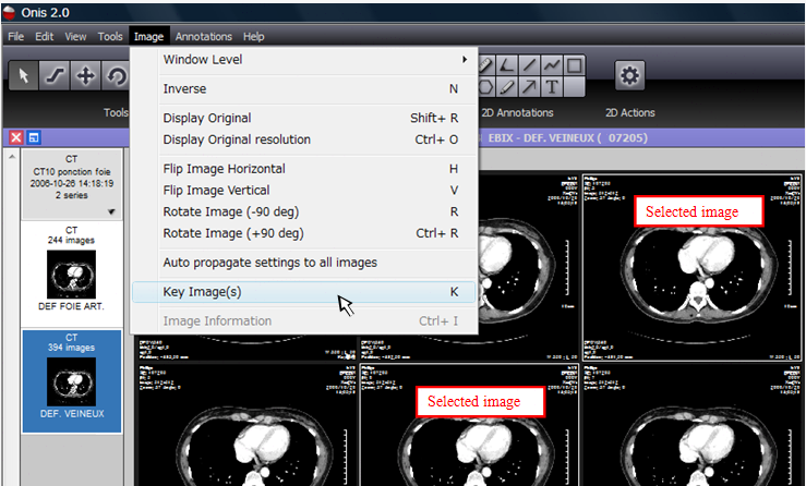 Onis Viewer - Dicom viewer and PACS