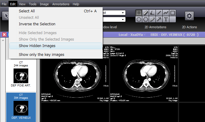 Onis Viewer - Dicom viewer and PACS