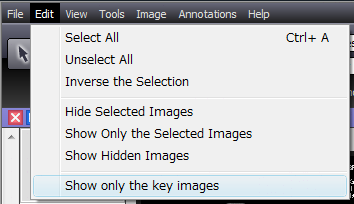 Onis Viewer - Dicom viewer and PACS