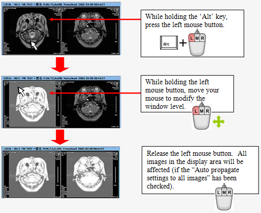 Onis Viewer - Dicom viewer and PACS
