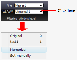 Onis Viewer - Dicom viewer and PACS