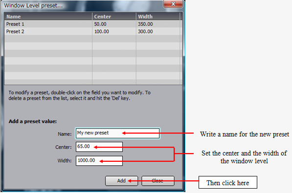 Onis Viewer - Dicom viewer and PACS