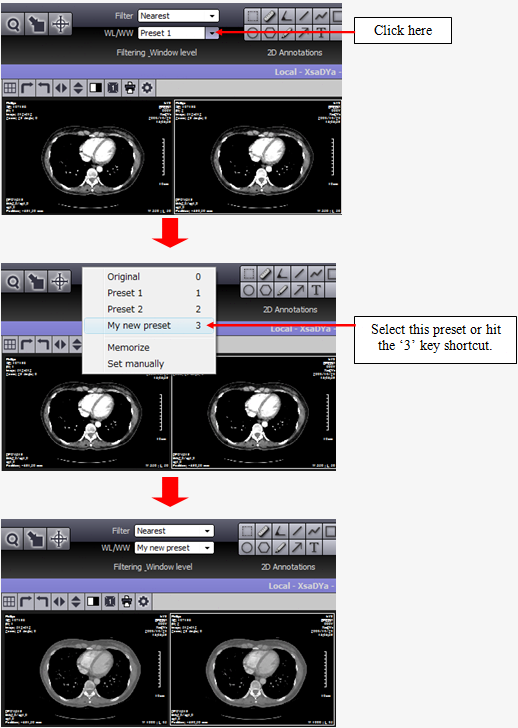 Onis Viewer - Dicom viewer and PACS