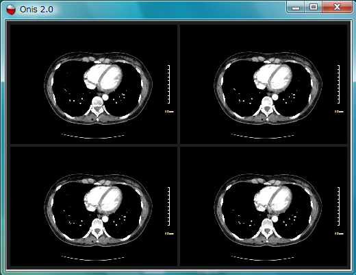 Onis Viewer - Dicom viewer and PACS