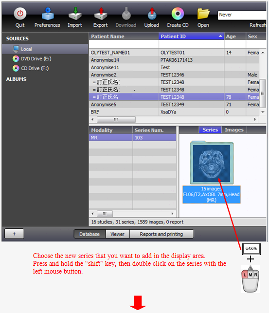 Onis Viewer - Dicom viewer and PACS