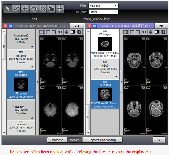 Onis Viewer - Dicom viewer and PACS