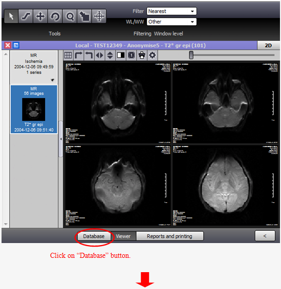 Onis Viewer - Dicom viewer and PACS