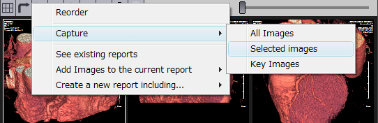 Onis Viewer - Dicom viewer and PACS