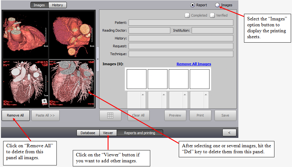 Onis Viewer - Dicom viewer and PACS