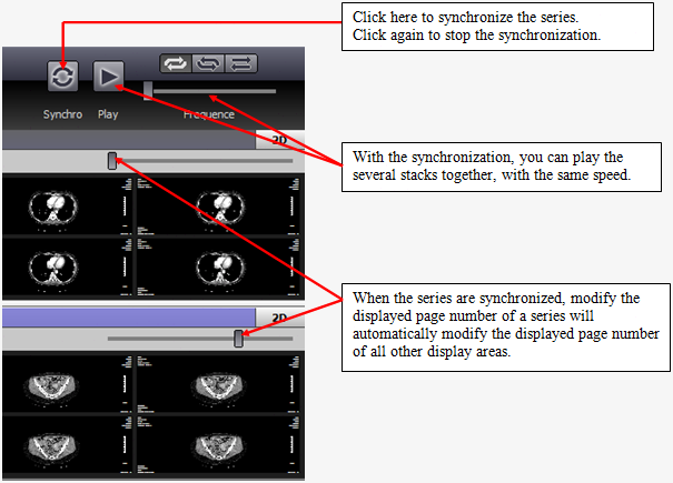 Onis Viewer - Dicom viewer and PACS