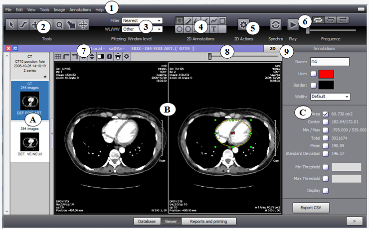 Onis Viewer - Dicom viewer and PACS