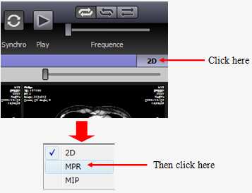 Onis Viewer - Dicom viewer and PACS