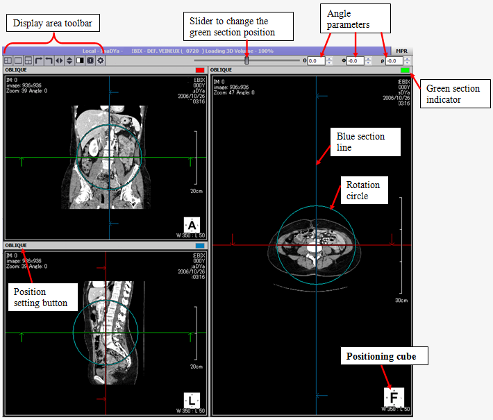 Onis Viewer - Dicom viewer and PACS