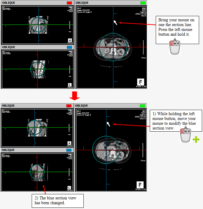 Onis Viewer - Dicom viewer and PACS