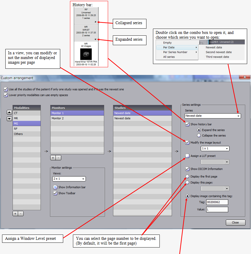Onis Viewer - Dicom viewer and PACS