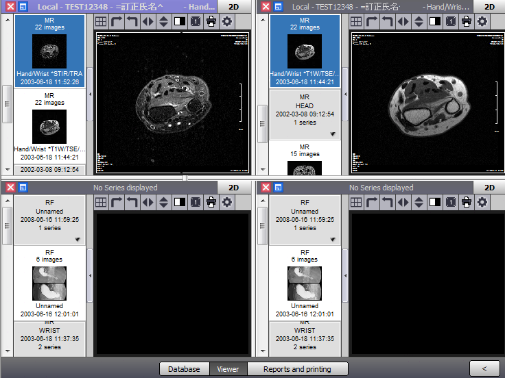 Onis Viewer - Dicom viewer and PACS